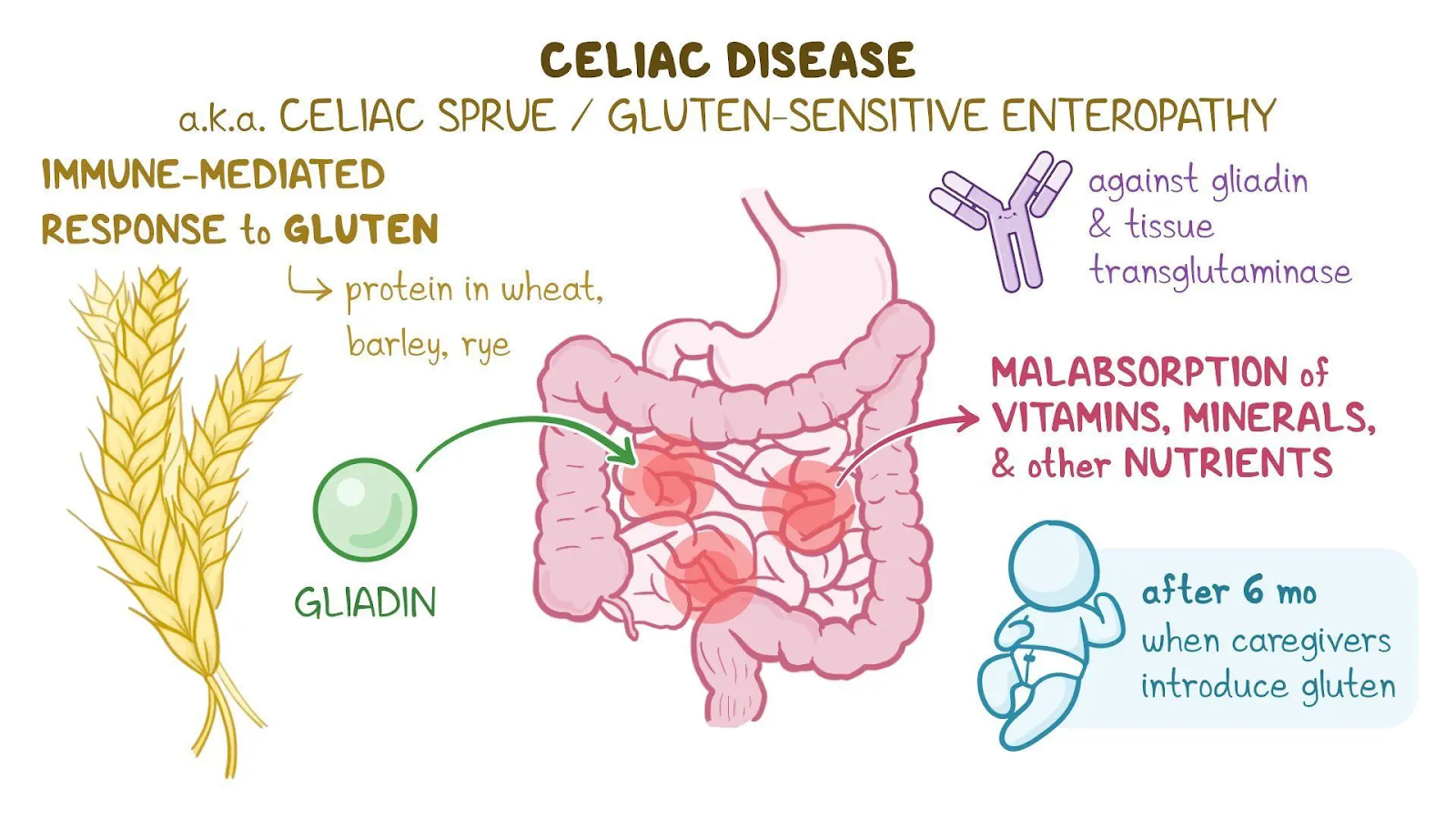 Recognizing Celiac Disease Awareness Month: Myths and Facts – The Caldron